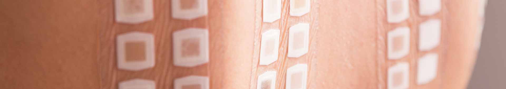 Patch Testing for Allergies in Charlotte | CAAC